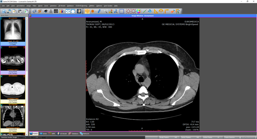 Sante DICOM Editor | The user interface