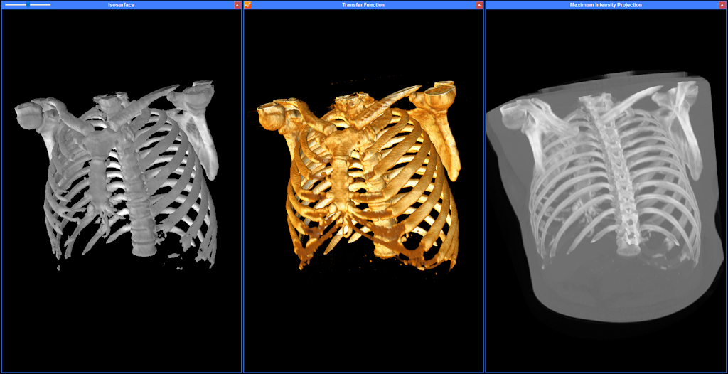 Sante DICOM Viewer Pro | The 3D Window