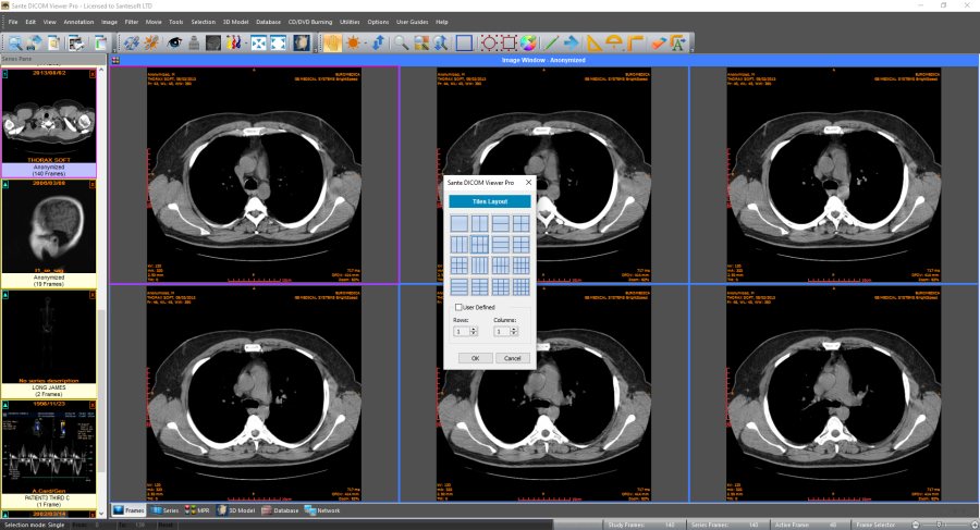 Sante DICOM Viewer Pro | The user interface
